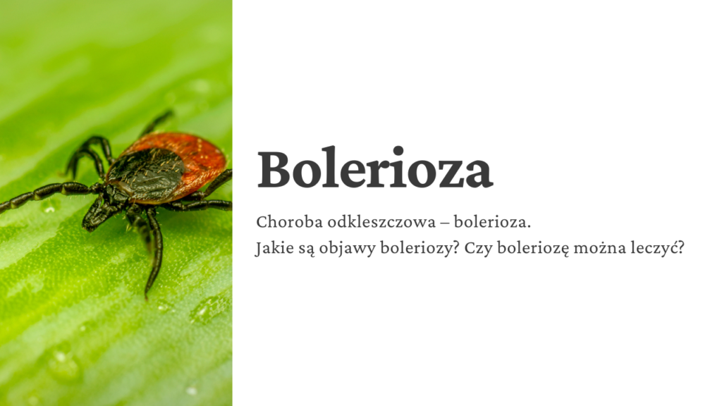 Borelioza – objawy i leczenie choroby | Portal Zdrowie