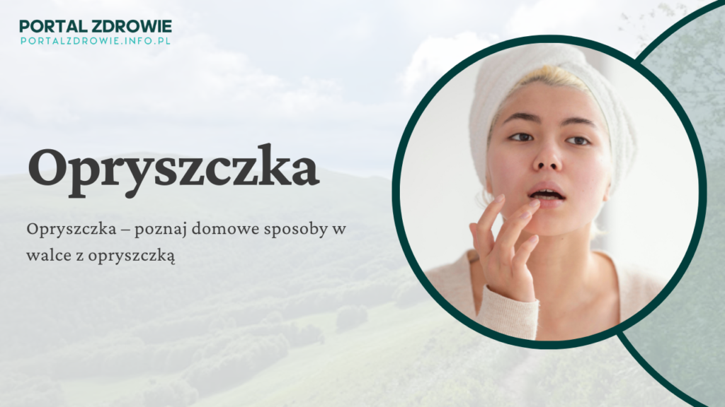 Domowe sposoby na opryszczkę. Jak wyleczyć opryszczkę w domu?