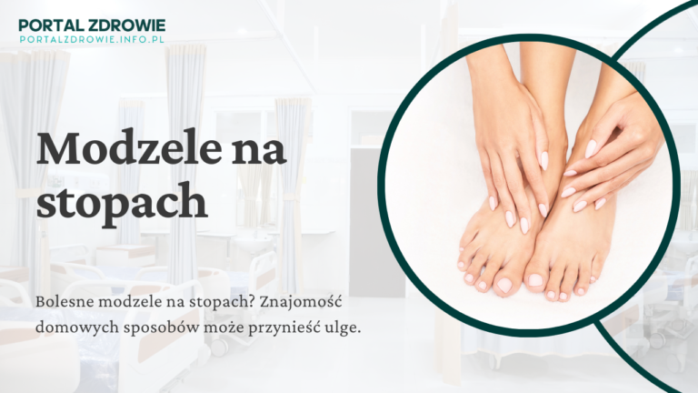 Co to są modzele na stopach? Sposoby na bolesne odciski